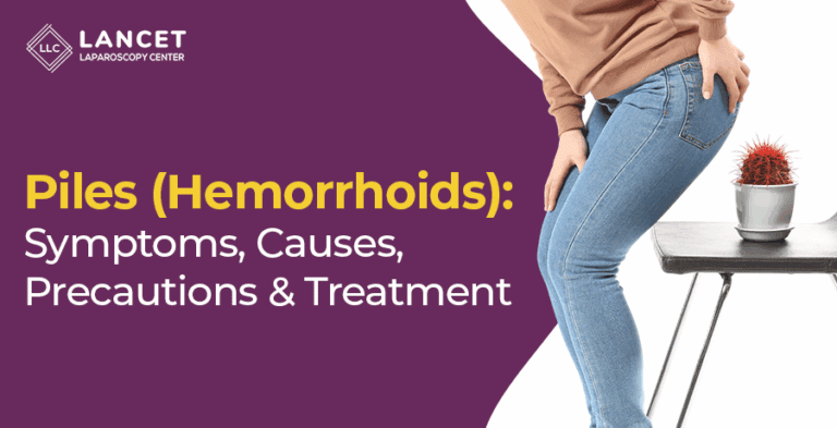 Piles Causes, Symptoms & Treatment | Lancet Laparoscopy Centre