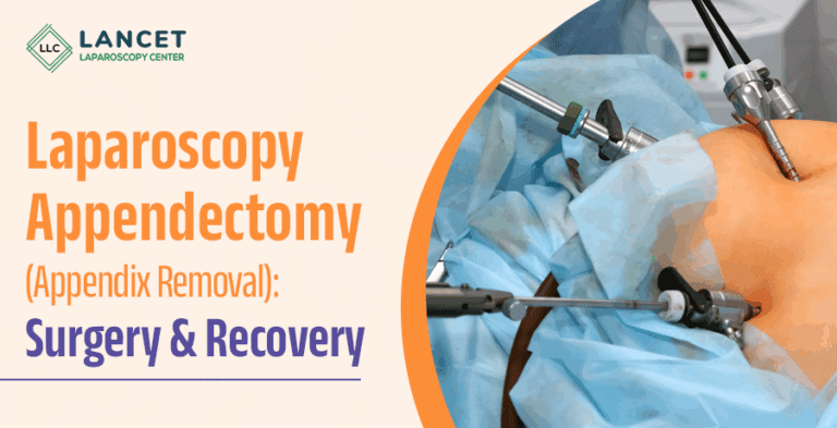 Umbilical Hernia Causes, Symptoms and Treatment - Lancet laparoscopy center